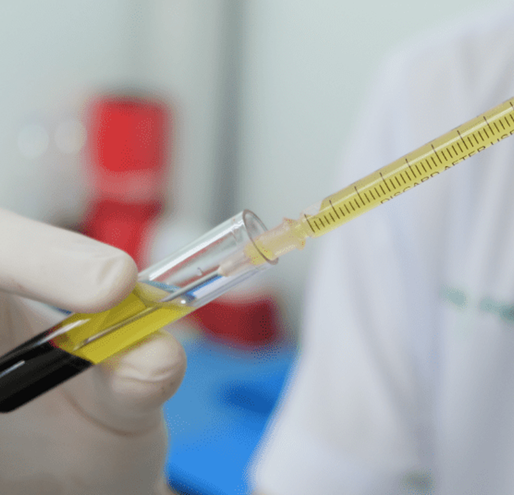 P-Shot: Improve Performance & Enhance Wellness